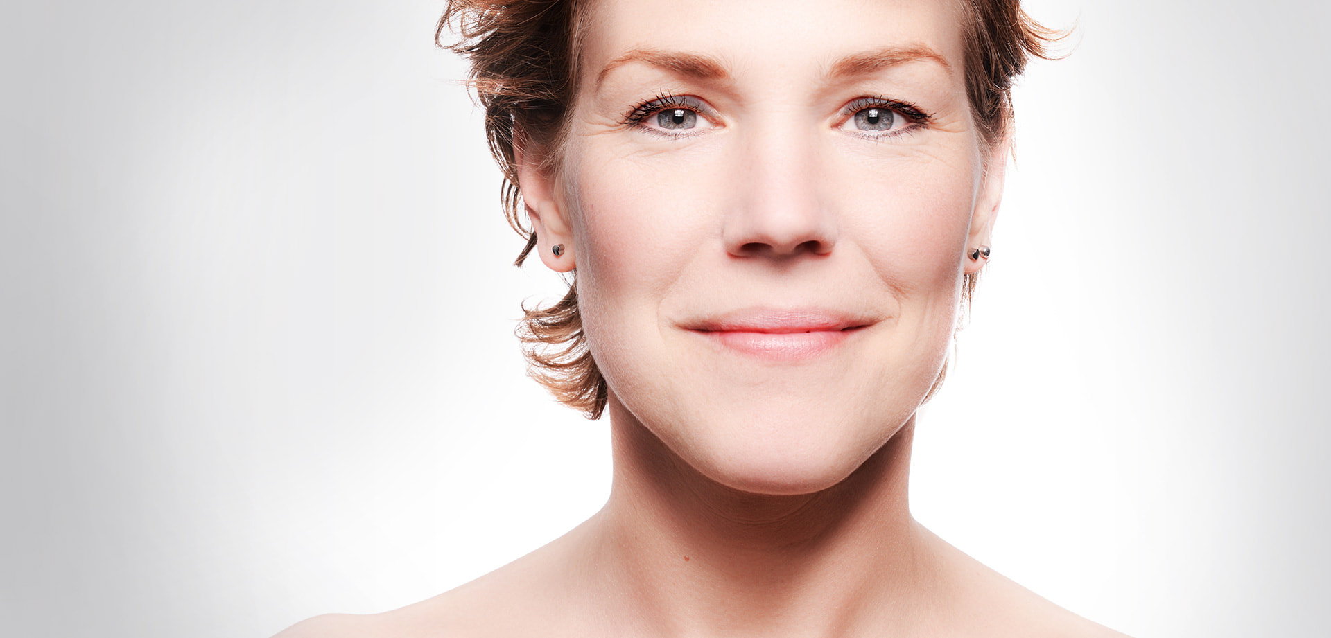 Secret™ RF Microneedling - Improve the Quality of Your Skin